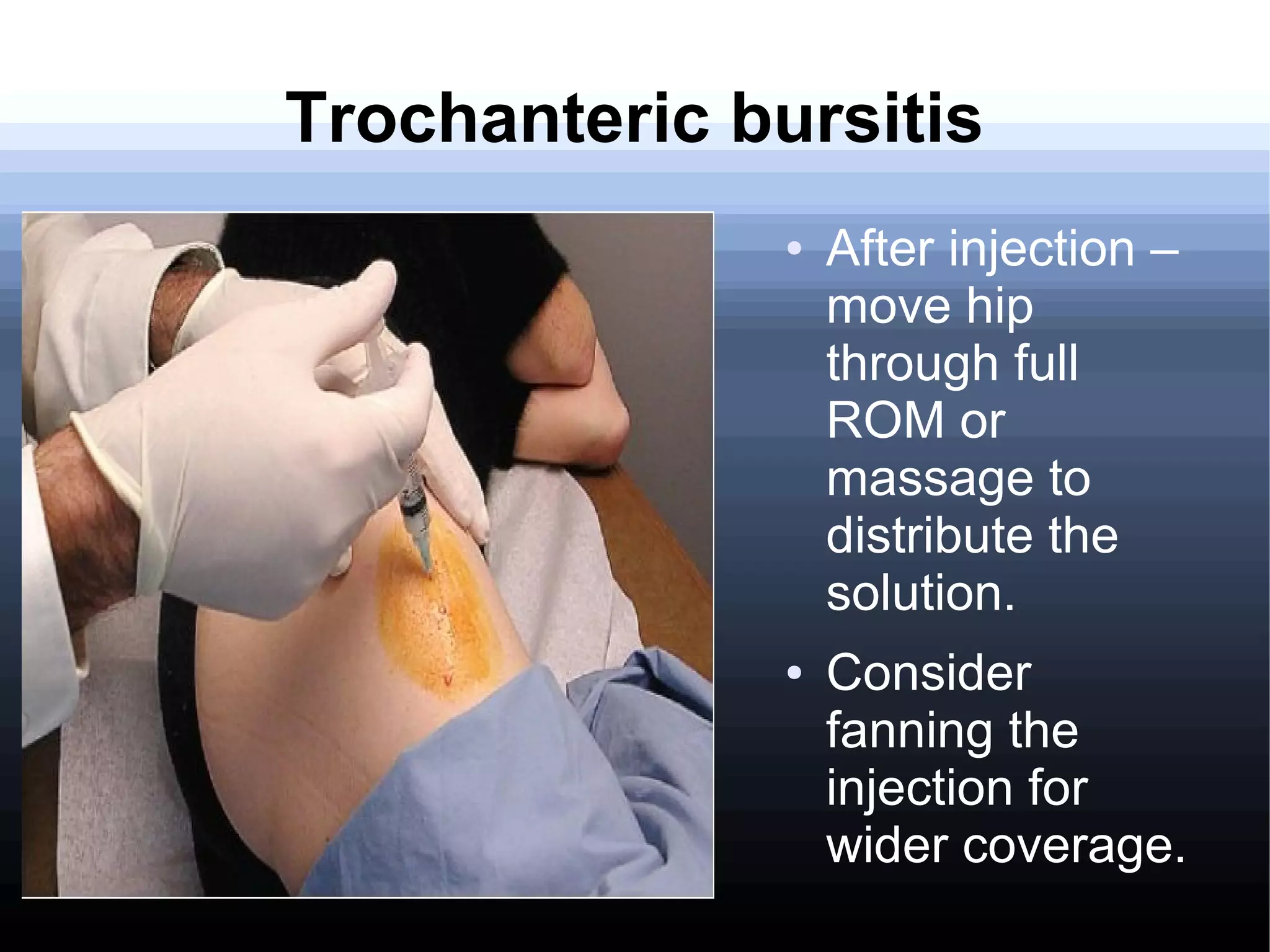 Corticosteroid injections in Orthopaedics | ODP