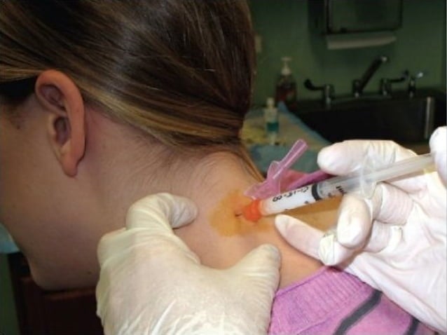 Corticosteroid injections in Orthopaedics | ODP | Death, Injury, or ...