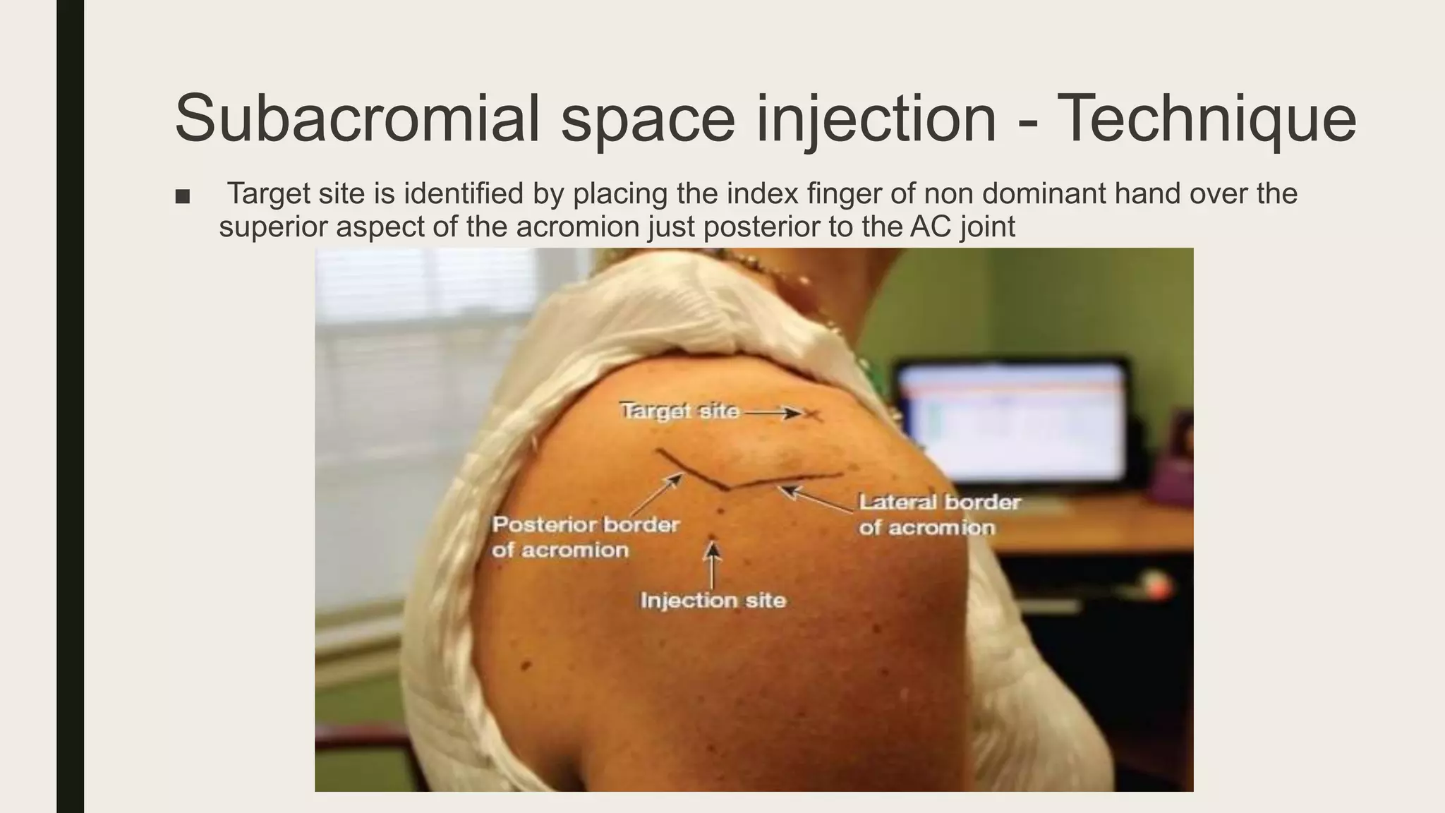 Corticosteroid injection techniques in orthopaedics | PPTX