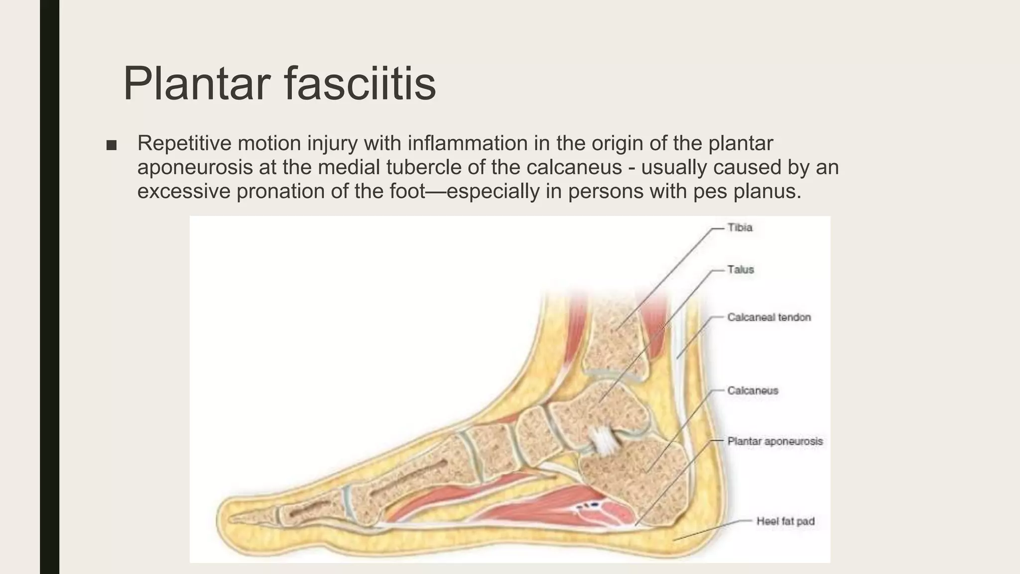 Corticosteroid injection techniques in orthopaedics | PPTX