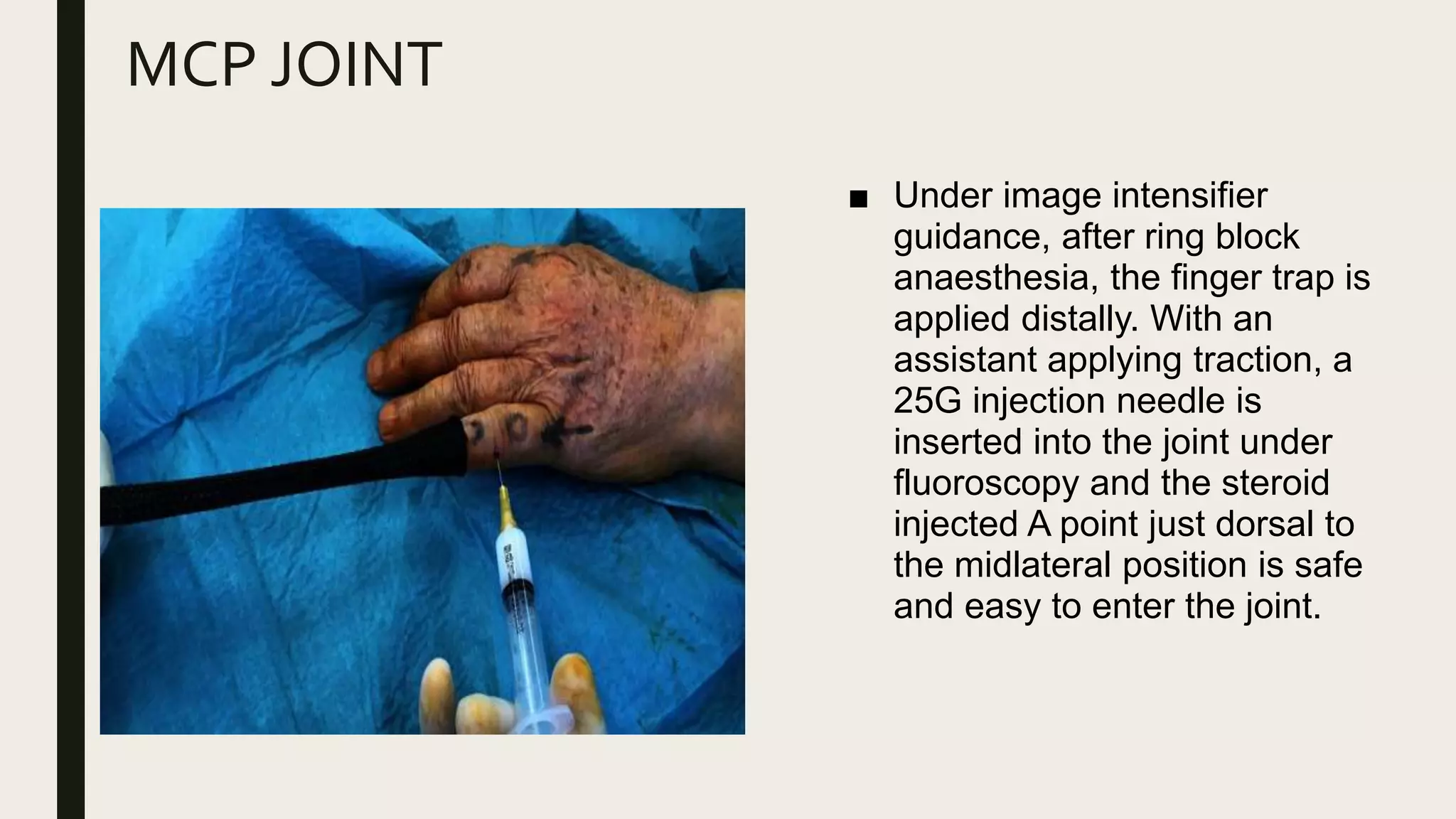 Corticosteroid injection techniques in orthopaedics | PPTX