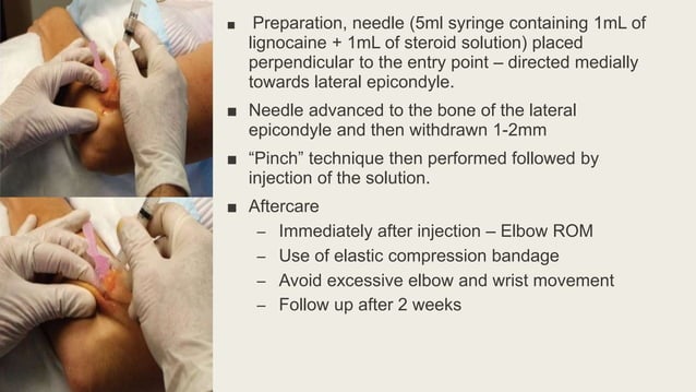 Corticosteroid injection techniques in orthopaedics | PPTX | Death ...