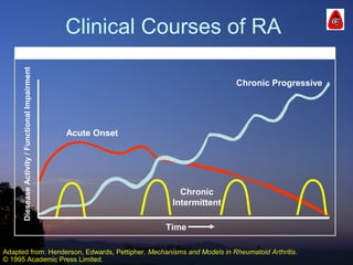 Use of Steroid in Rheumatology | PPT