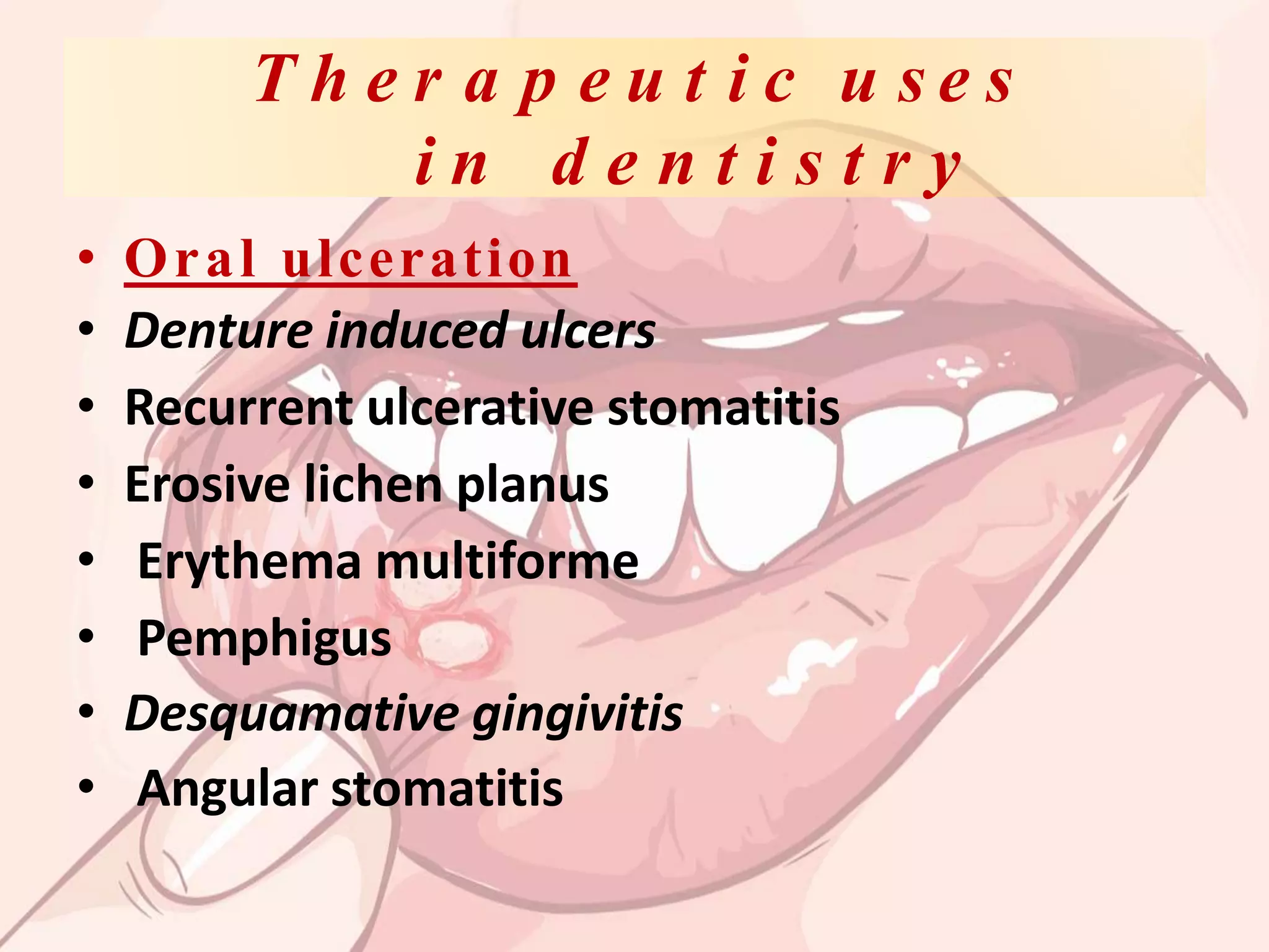Corticosteroids in dentistry | PPTX
