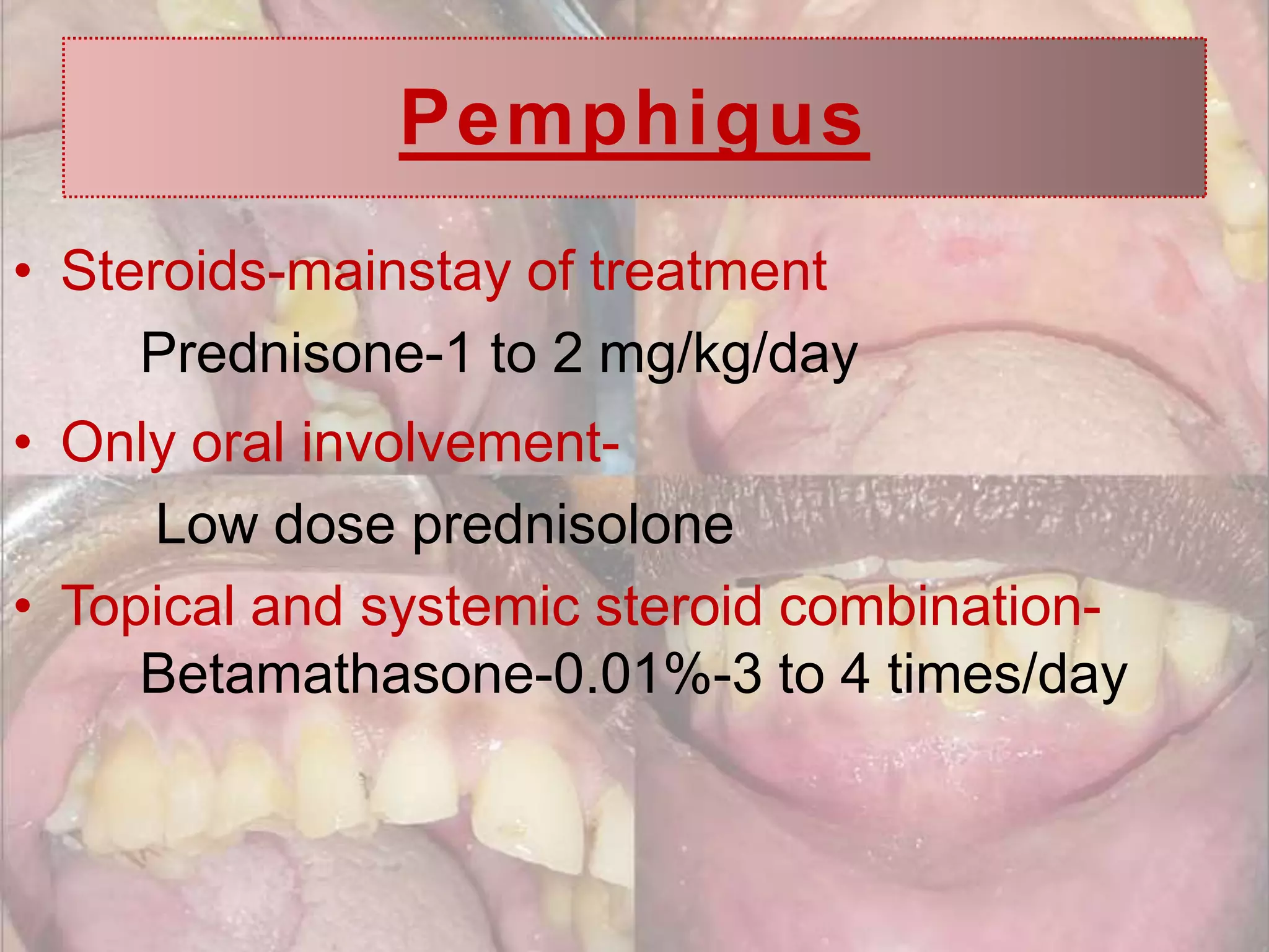 Corticosteroids in dentistry | PPTX
