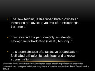 Corticotomy for Rapid Acceleration | PPTX