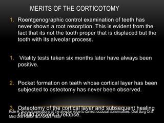 Corticotomy for Rapid Acceleration | PPTX