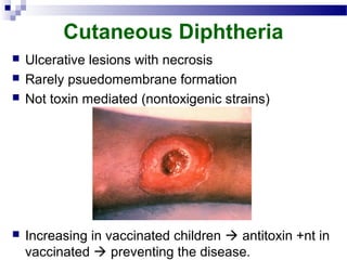 Corynebacteria by Dr. Rakesh Prasad Sah | PPT