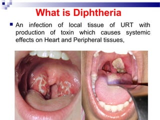 Corynebacteria by Dr. Rakesh Prasad Sah | PPT