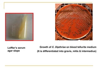 Corynebacteria species short notes on ppt | PPT