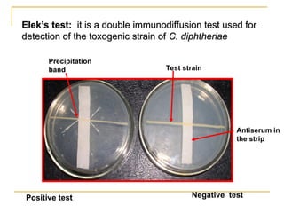 Corynebacteria species short notes on ppt | PPT
