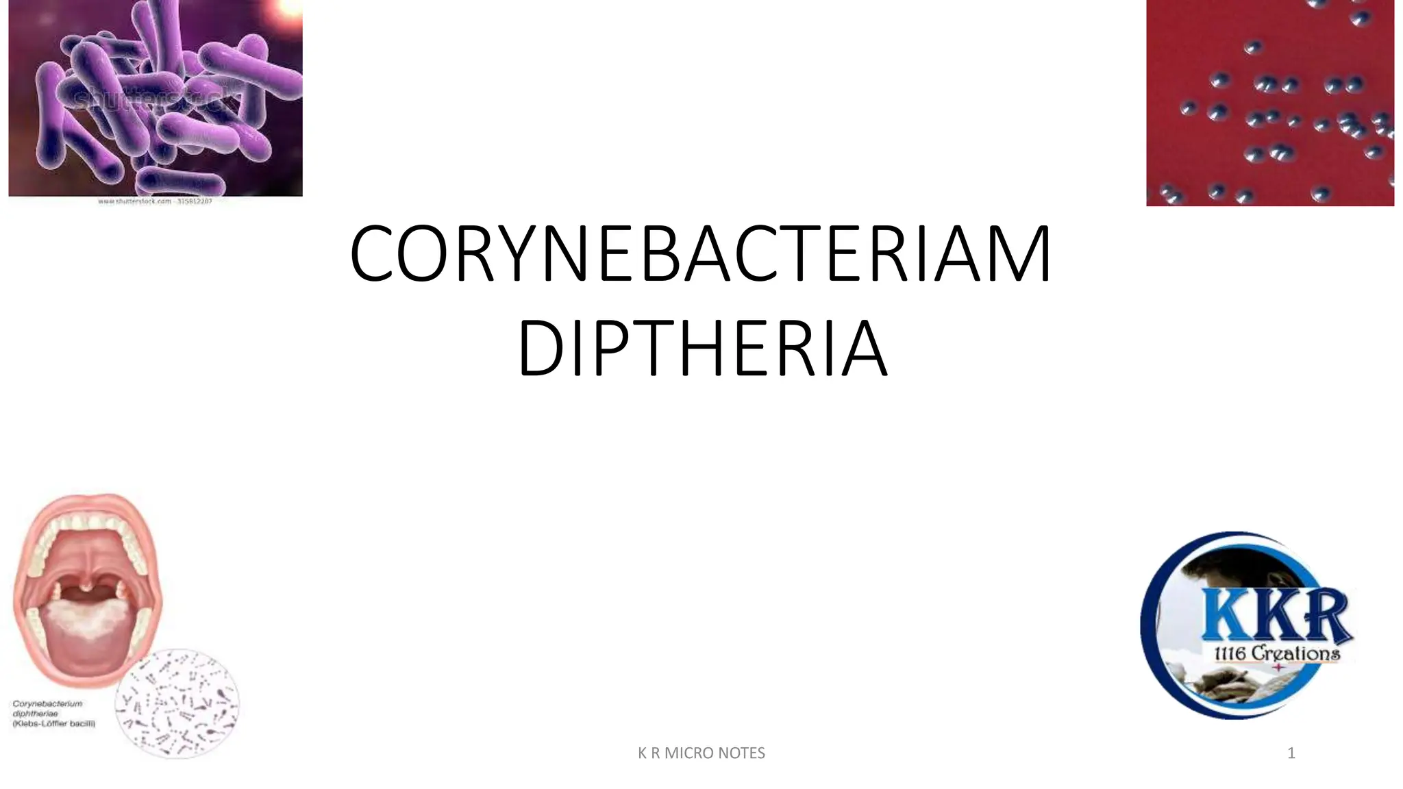 CORYNEBACTERIAM DIPTHERIA INFECTIONS K R.pptx