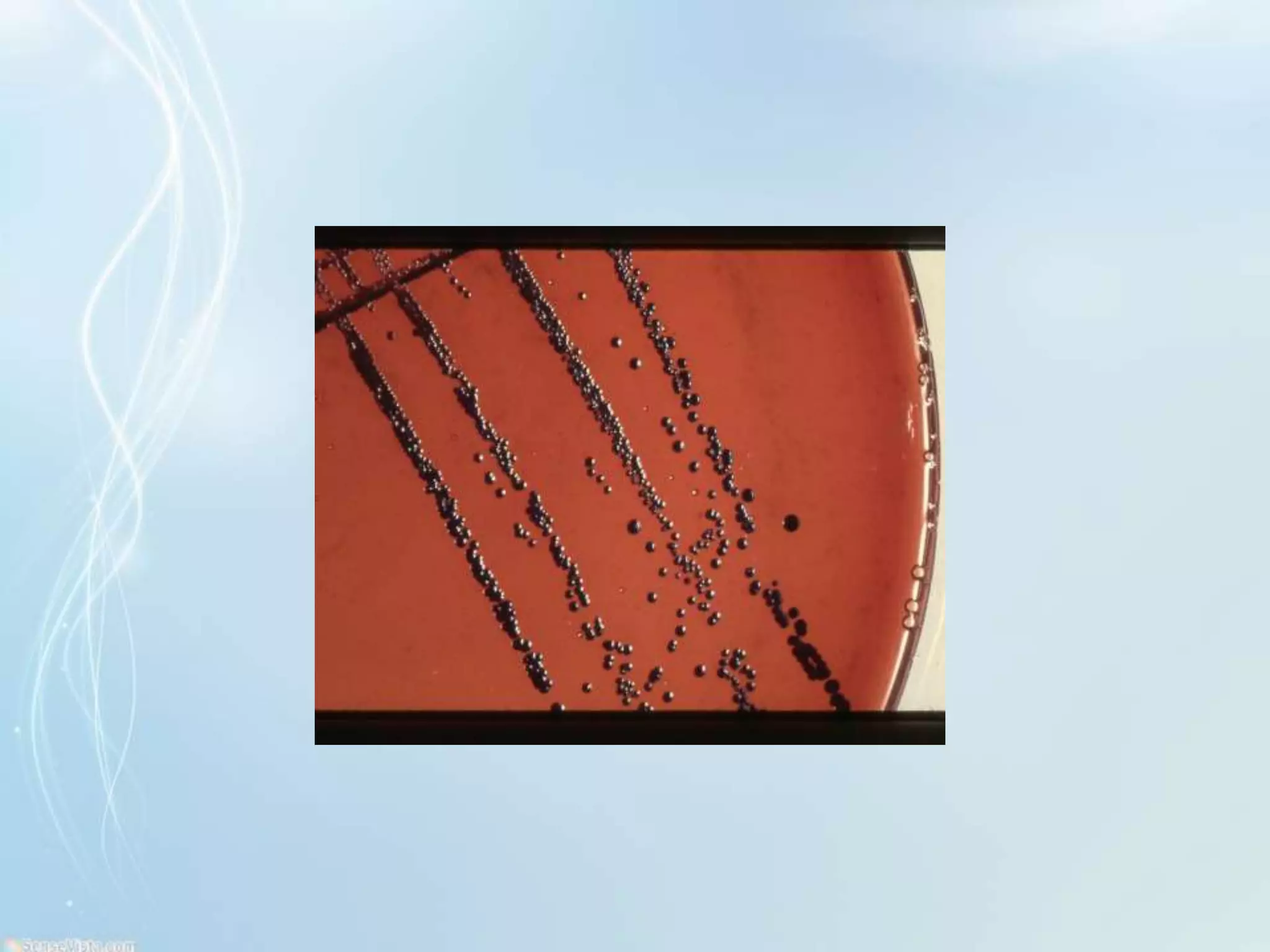 Corynebacterium | PPTX