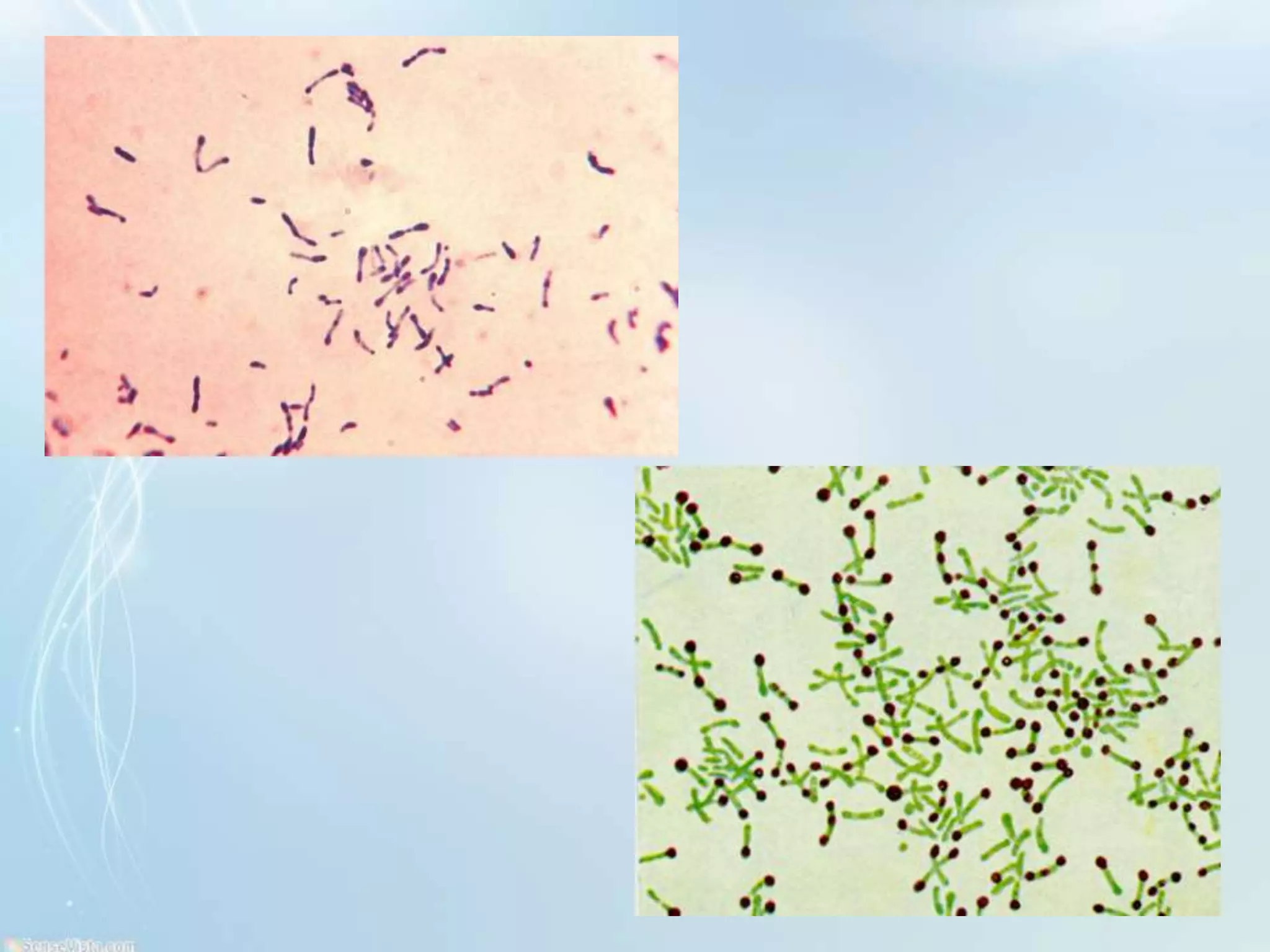 Corynebacterium | PPTX