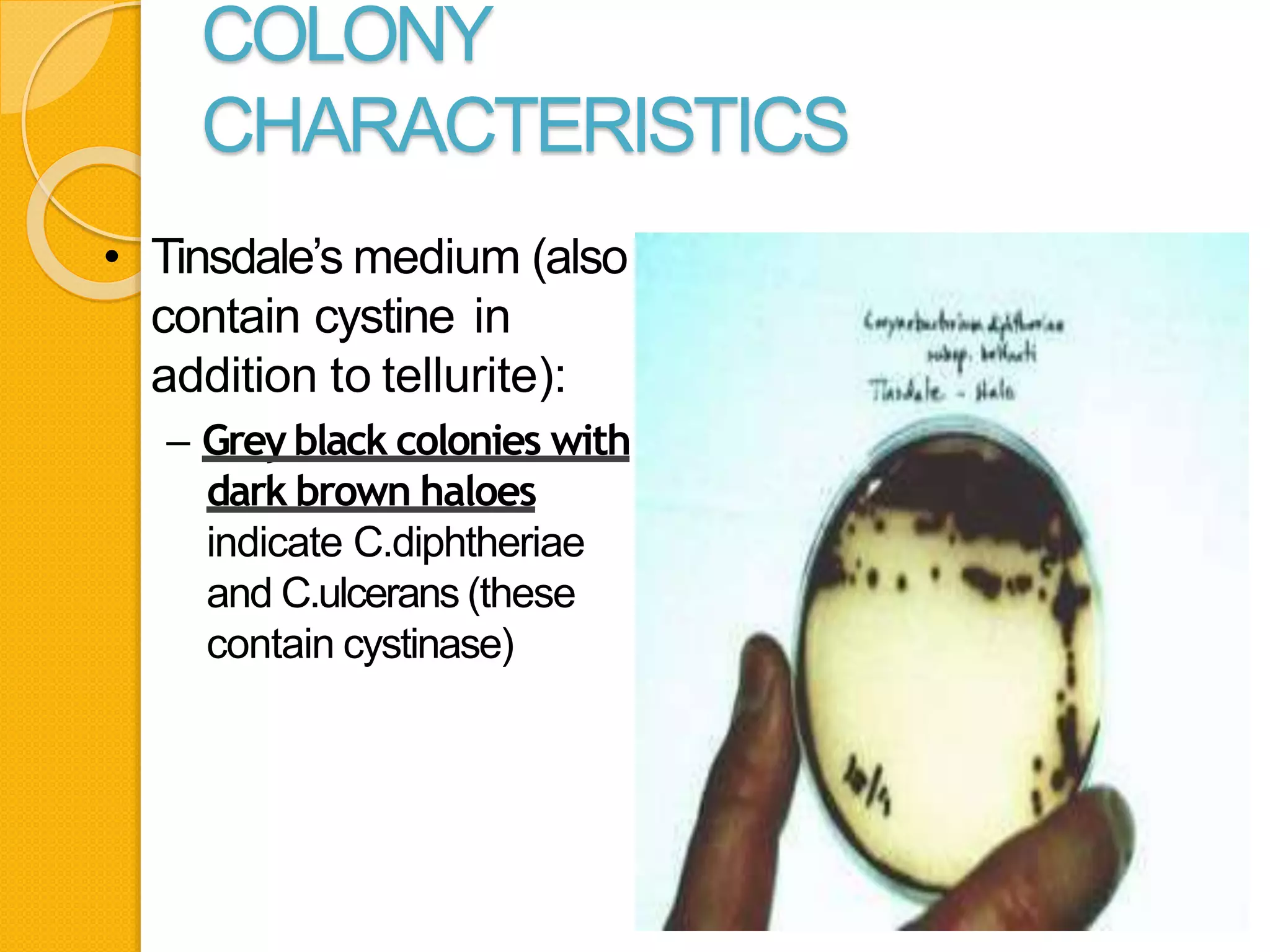 Bacterial diseases - Corynebacterium | PPTX | Ear, Nose and Throat ...