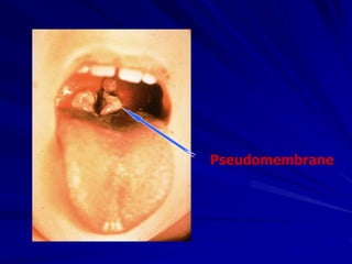 عملي Corynebacterium-1 (Muhadharaty).ppt