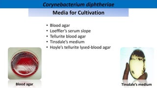 Corynebacterium diphtheriae | PPT