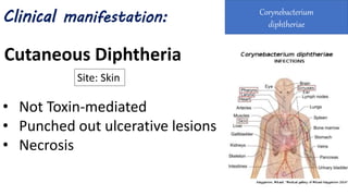 Corynebacterium | PPTX