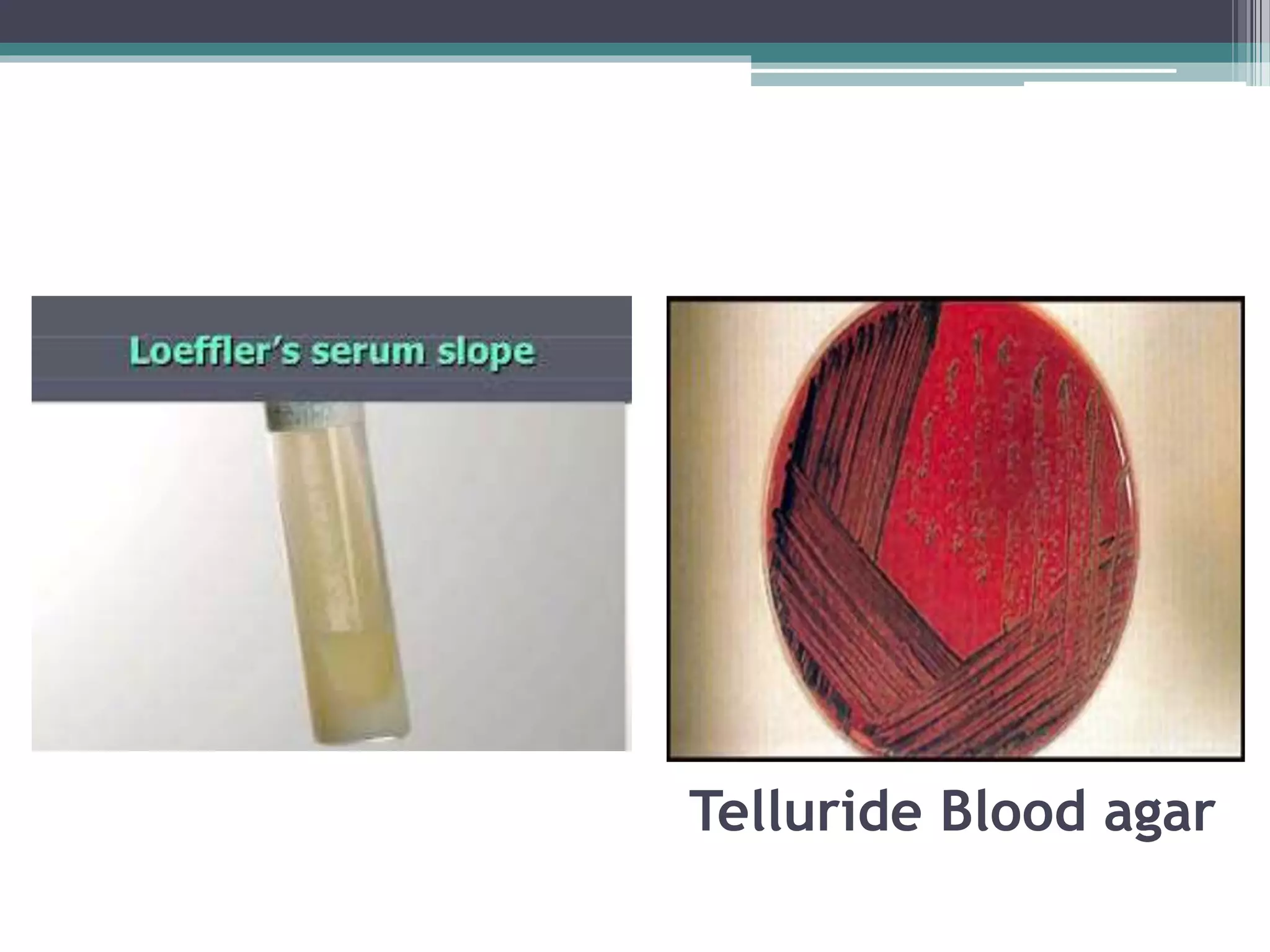 CORYNEBACTERIUM (Diphtheria).pptx