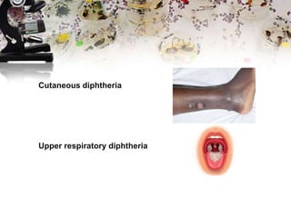 Corynebacterium diphtheriae | PPTX