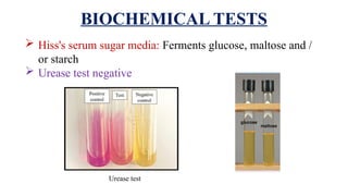 CORYNEBACTERIUM DIPHTHERIAE (Diphtheria) GPB.pptx | Ear, Nose and ...