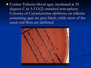 Corynebacterium diphtheriae b.carl