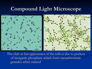 Corynebacterium diphtheriae b.carl