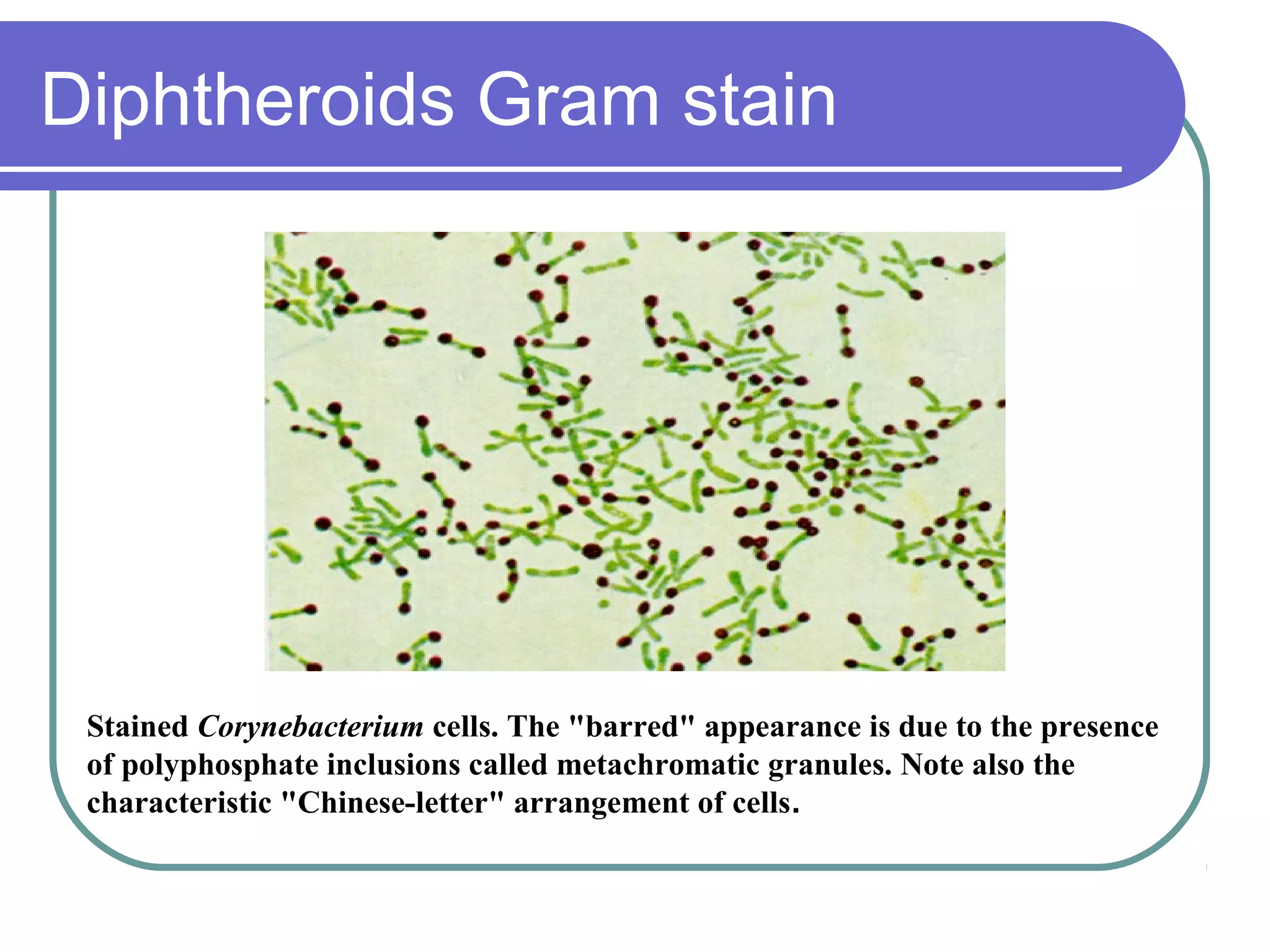 Corynebacterium diptheriae(Microbiology) | PPT