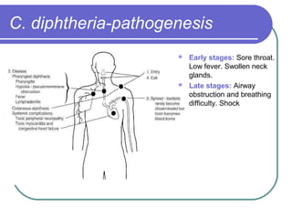 Diphtheria Diagram