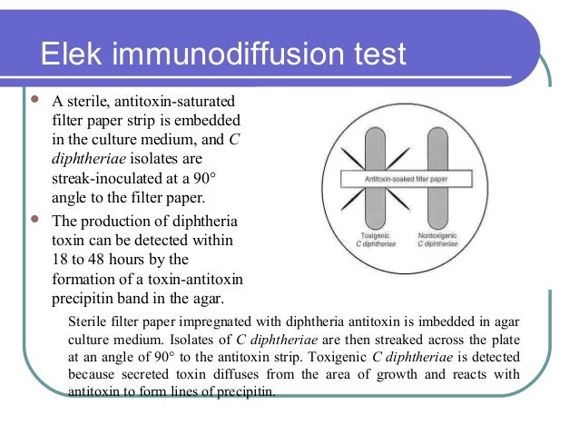 Corynebacterium diptheriae(Microbiology)