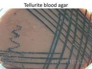 Corynebacterium diptheriae | PPTX