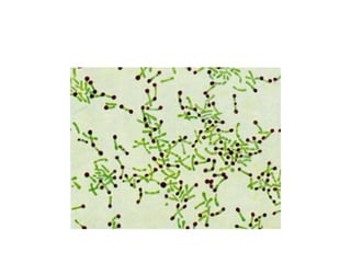 Corynebacterium Diphtheriae Albert Stain