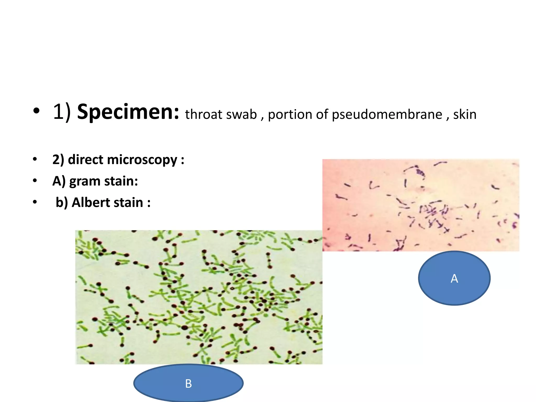 Corynebacterium diptheriae | PPT