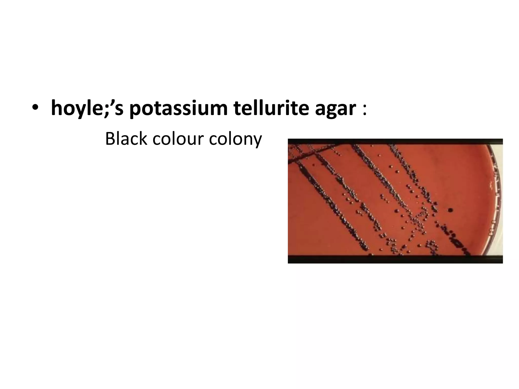 Corynebacterium diptheriae | PPT
