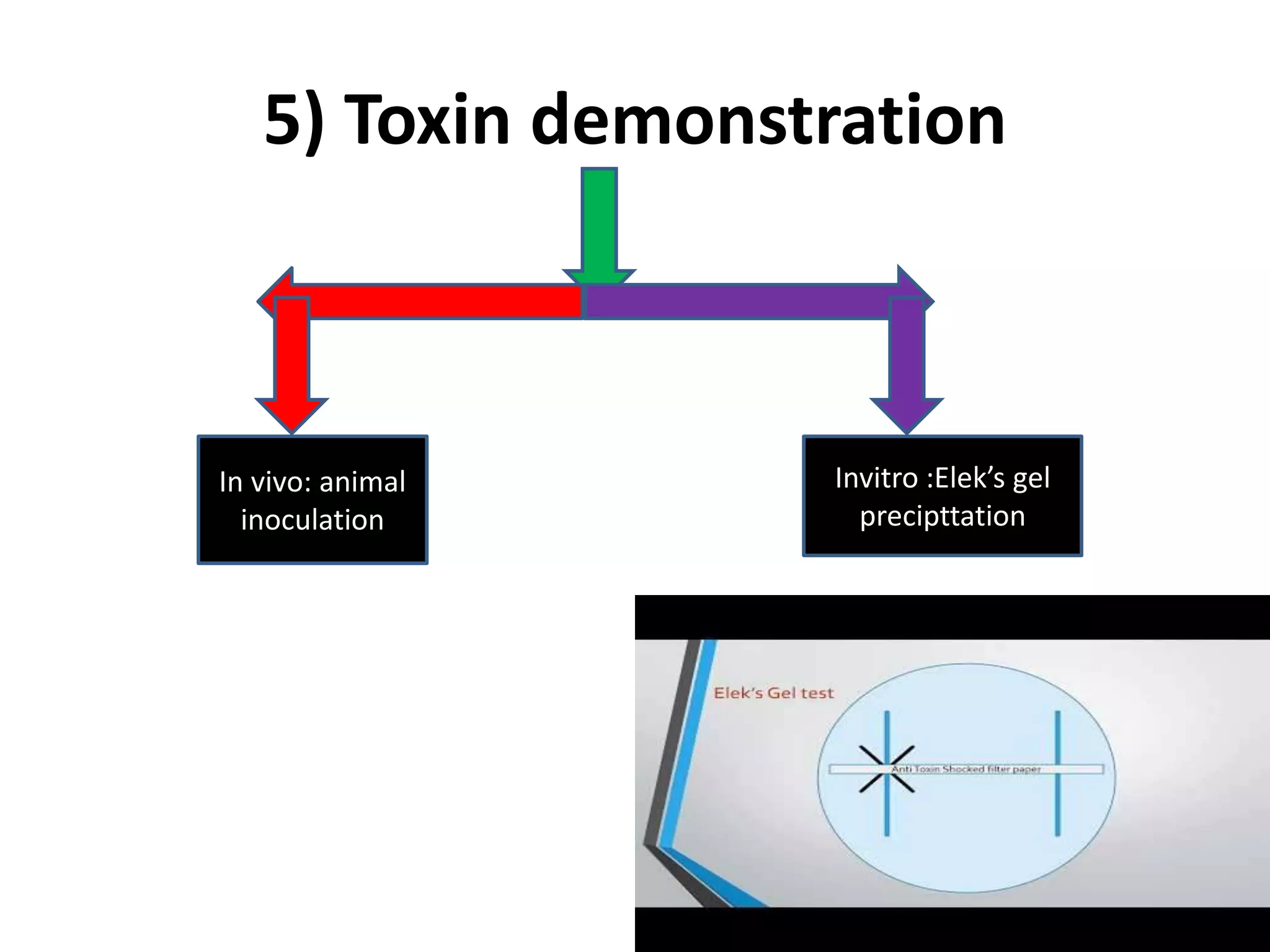 Corynebacterium diptheriae | PPT