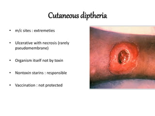 Corynebacterium diptheriae | PPT