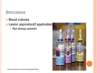 lCorynebacterium jeikeium | PPT