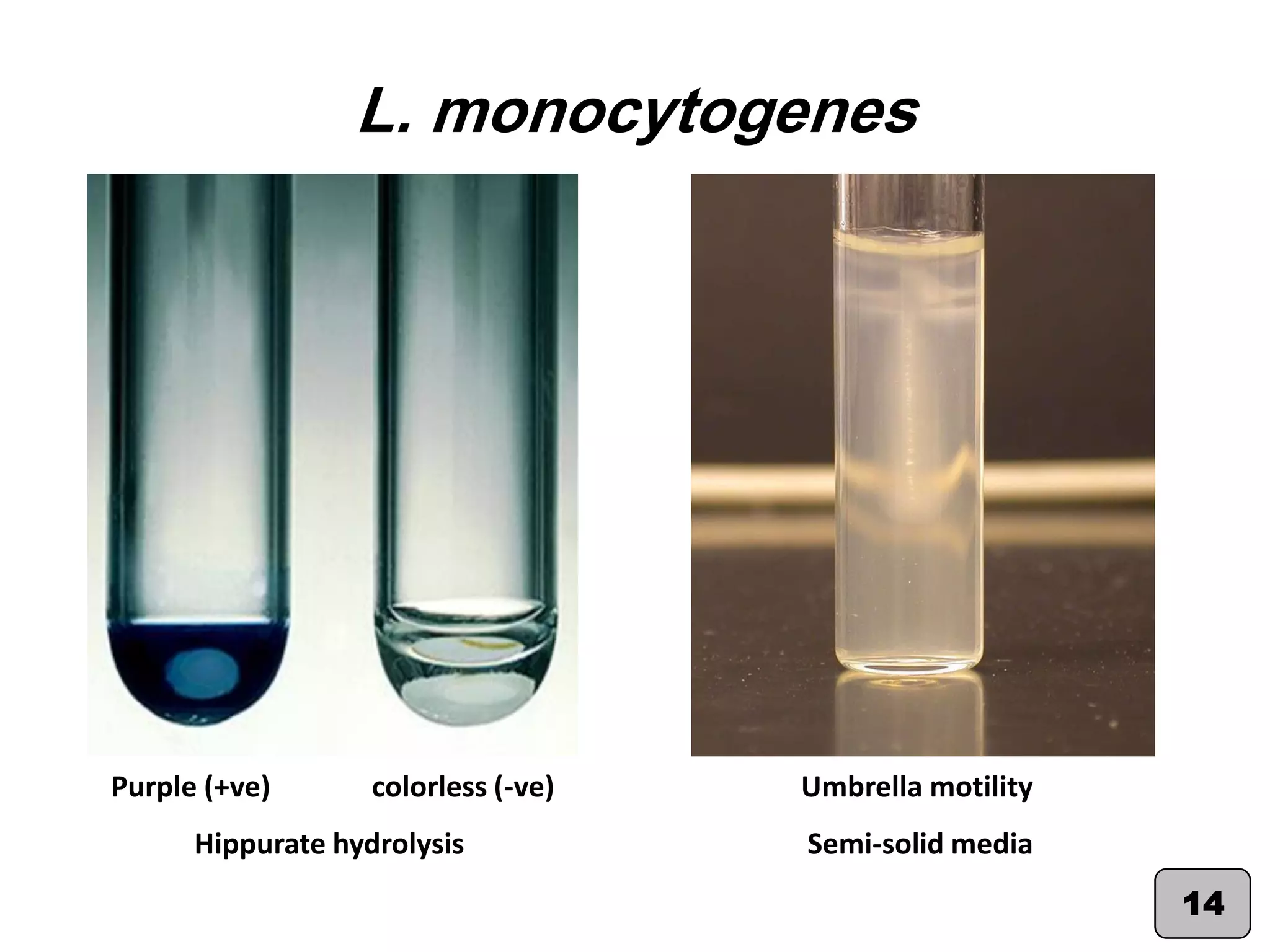 Corynebacterium spp. & Listeria monocytogenes (Practical Medical ...