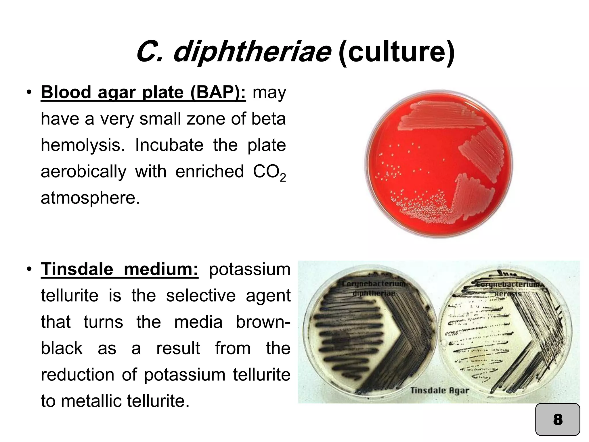 Corynebacterium spp. & Listeria monocytogenes (Practical Medical ...