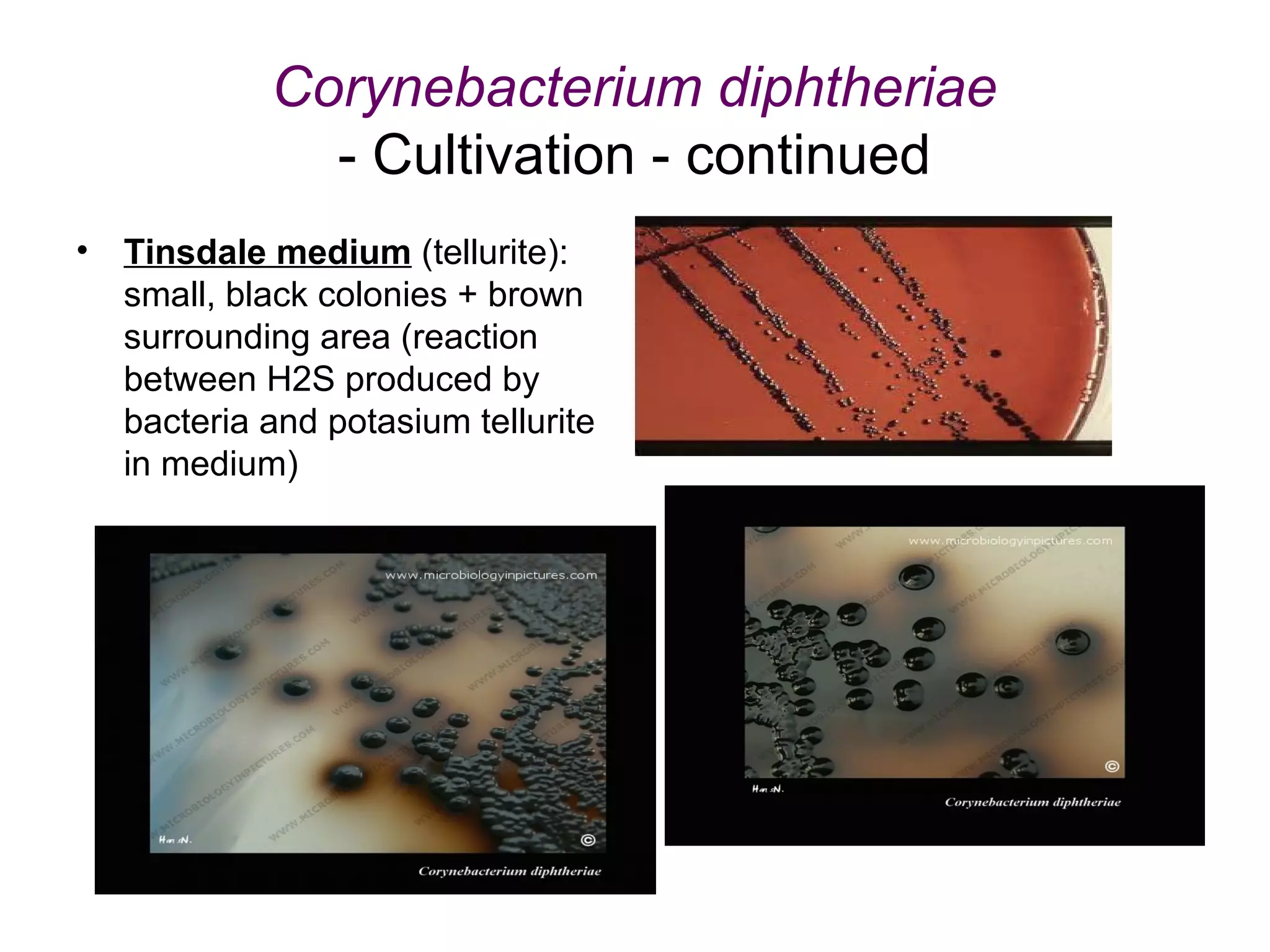 Corynebacterium listeria erysipelothrix_bacillus | PPT