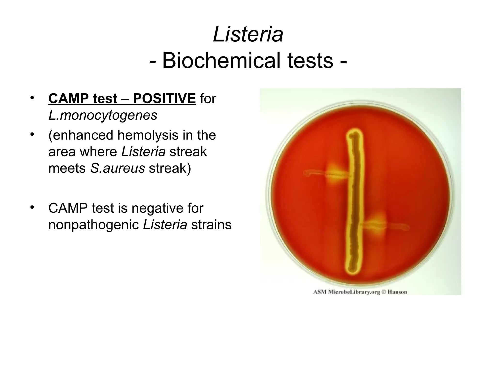 Corynebacterium listeria erysipelothrix_bacillus | PPT