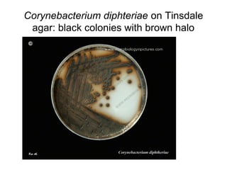 Corynebacterium listeria erysipelothrix_bacillus | PPT