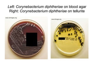 Corynebacterium listeria erysipelothrix_bacillus | PPT