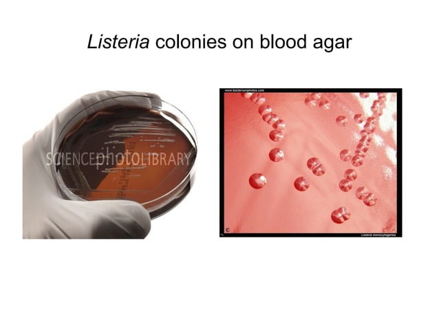 Corynebacterium listeria erysipelothrix_bacillus | PPT