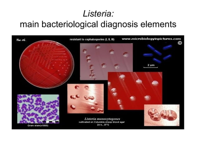 Corynebacterium listeria erysipelothrix_bacillus | PPT