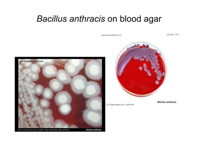 Corynebacterium listeria erysipelothrix_bacillus | PPT