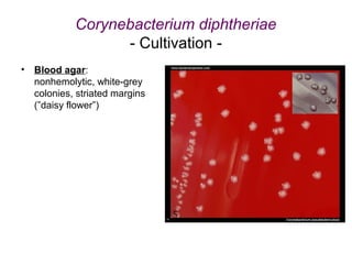Corynebacterium listeria erysipelothrix_bacillus | PPT