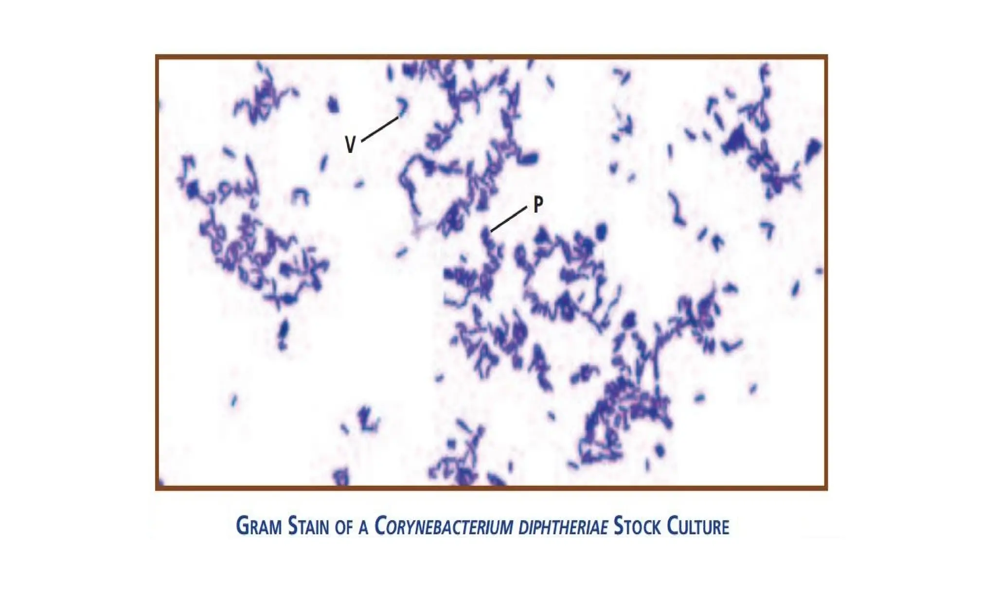 Corynebacterium notes by SANJU SAH(Vyagute rog).pptx