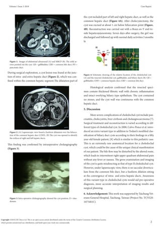A Rare Case of Choledochal Cyst Connecting Intra- And ExtraHepatic Duct | PDF
