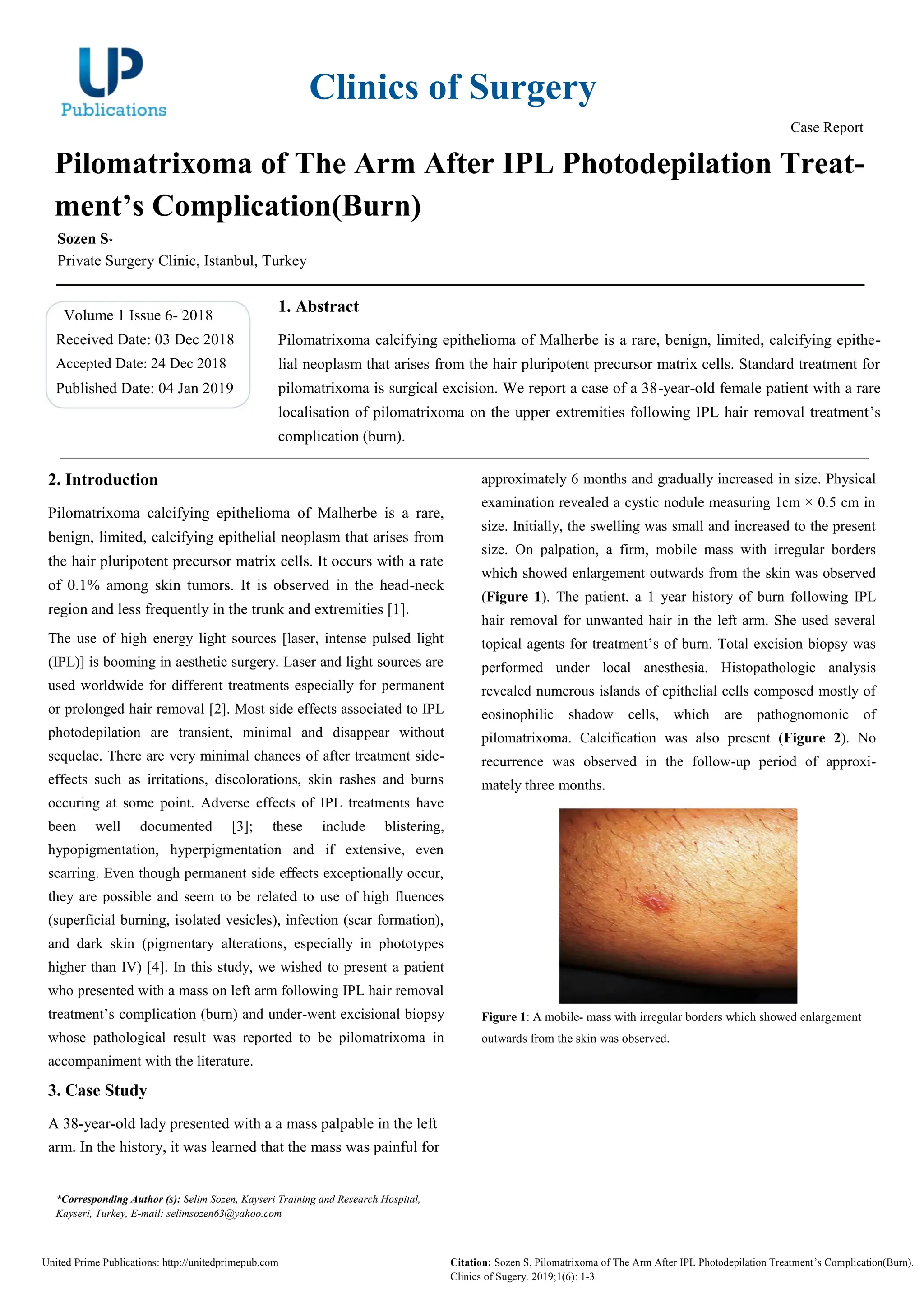Pilomatrixoma of the Arm After IPL Photodepilation Treat-ments ...